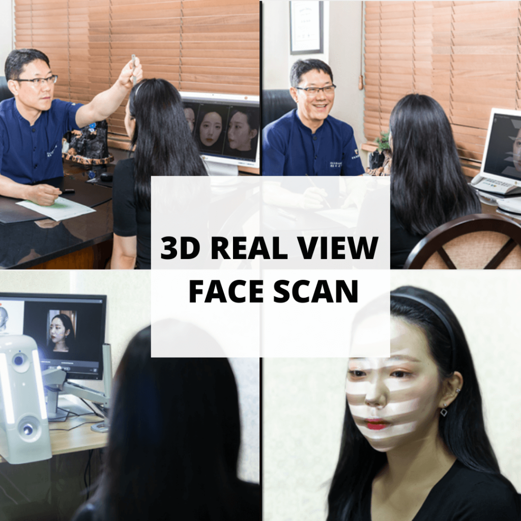 3D hair-line scan - Root Hair Transplant Clinic